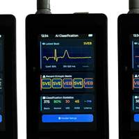 HealthyPi 6 - On-Device Edge ML - Real-Time Beat Classification | Crowd ...
