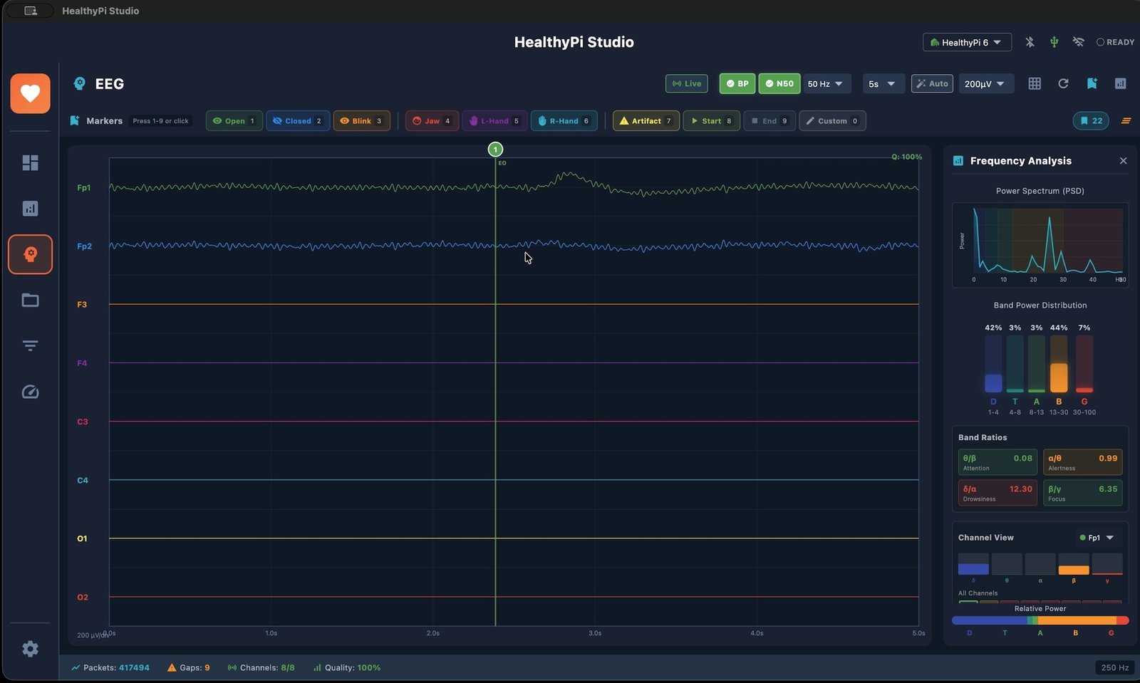 HealthyPi 6 - EEG in Action | Crowd Supply